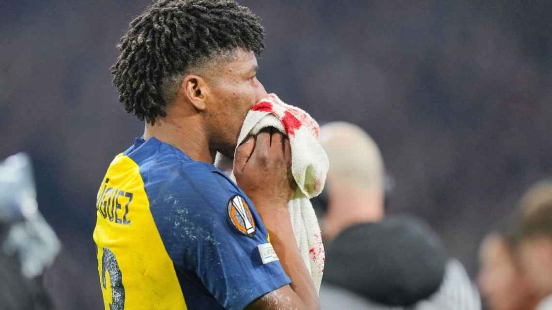 Kevin Rodríguez expresó su malestar por el golpe que recibió en ...